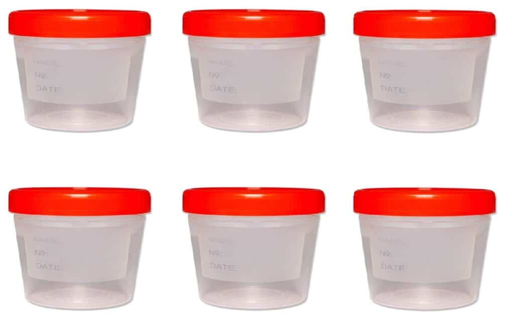 Urine Sample: Collection And Preservation